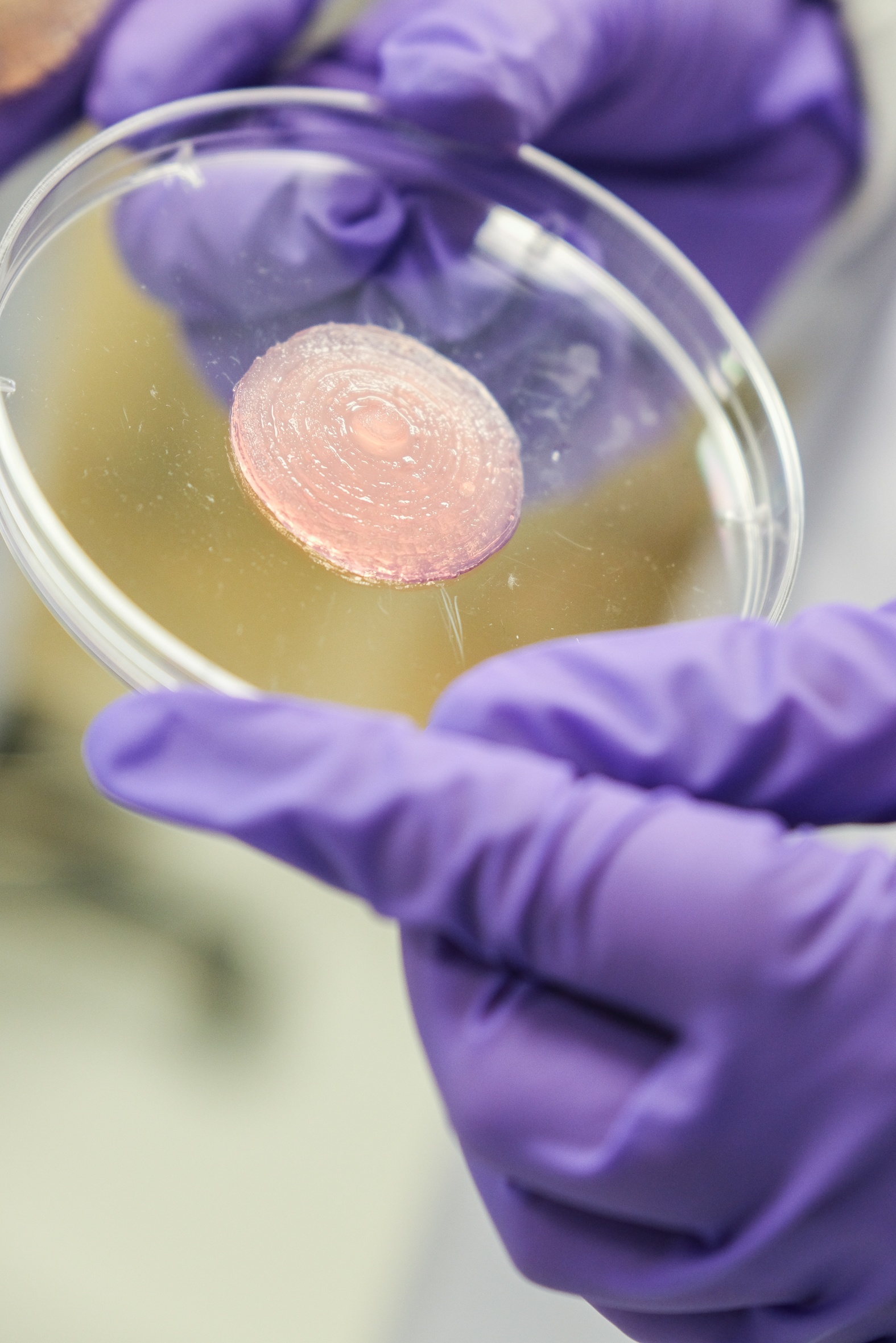 Healshape has a disruptive and secured technology